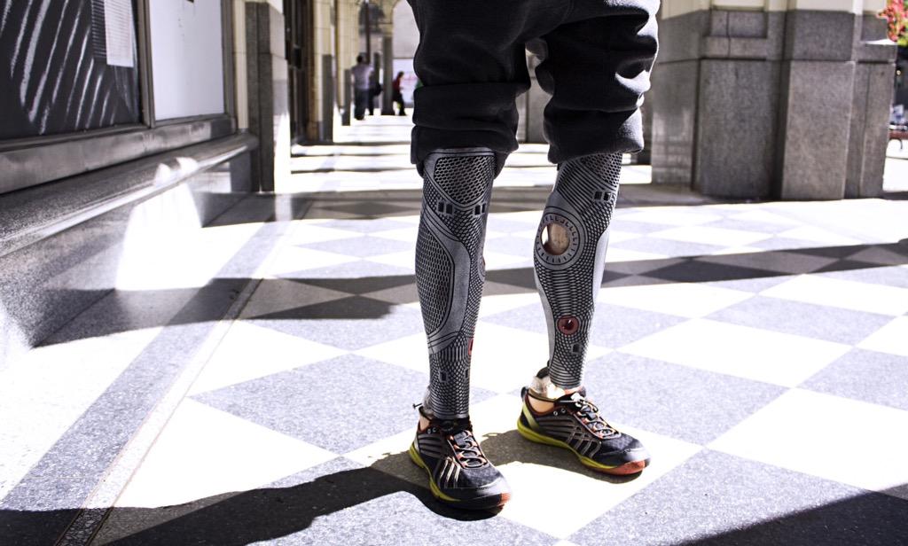 Lower Limb Prosthetics in QLD | APO